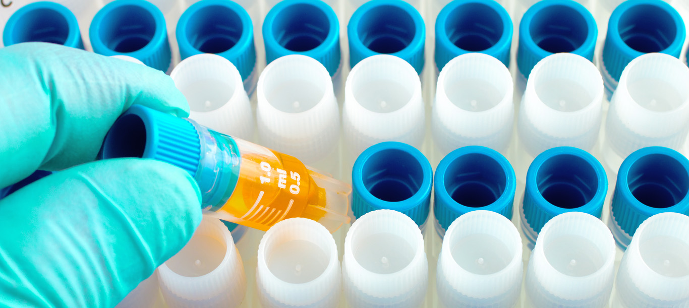 Cell lines-Vitro Biotech